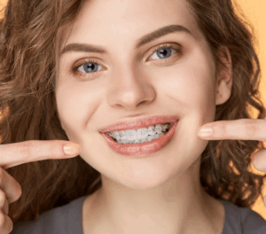 Clear Fixed Braces | Park Orthodontics Glasgow