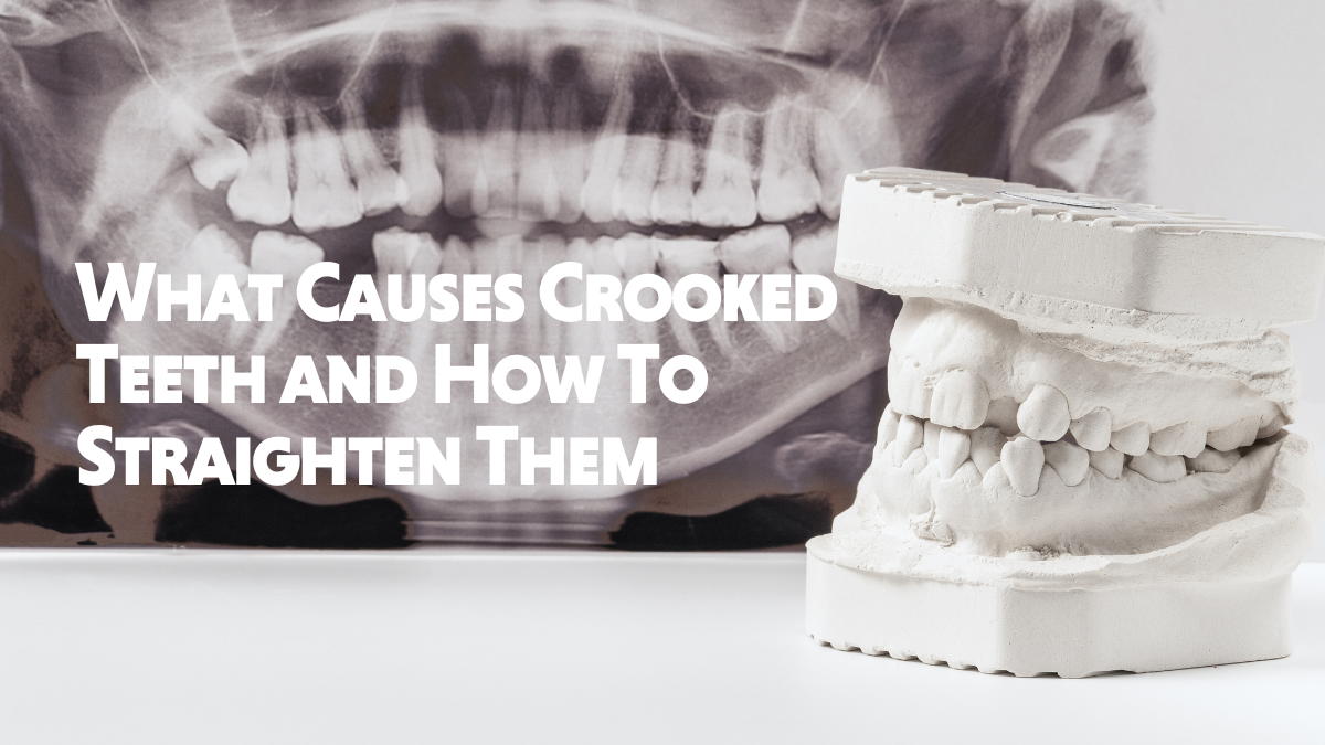 Find Out What Causes Crooked Teeth and How To Straighten Them