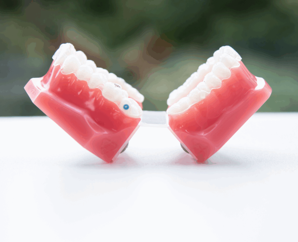 Broken Braces? What To Do if a Bracket or Wire Breaks 👍️